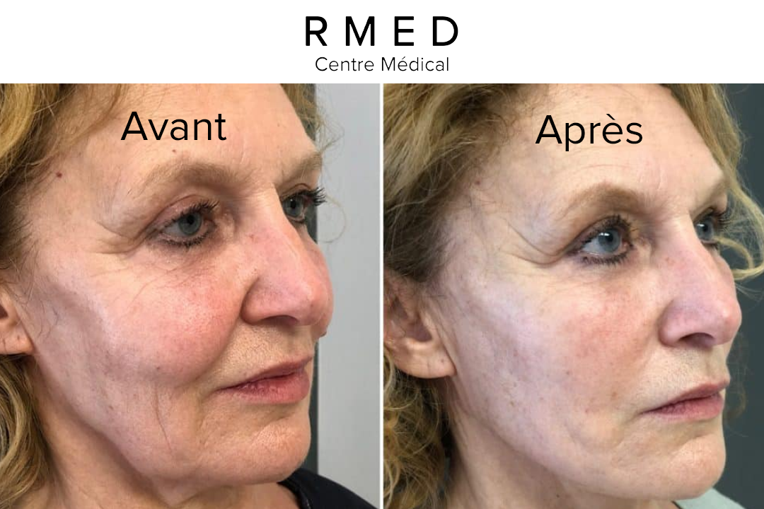 Traitements Esthétiques - RMed